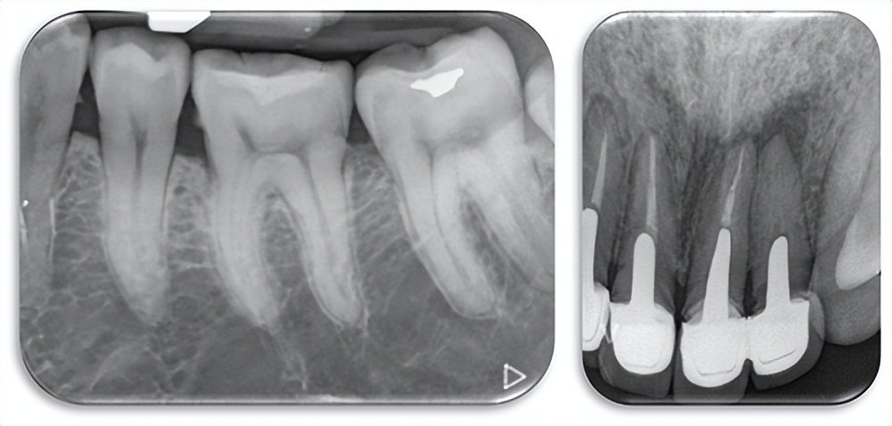 国内首台加持小牙片的口腔CT，博爵五合一CBCT是如何一次性解锁口腔影像全需求的？_凤凰网