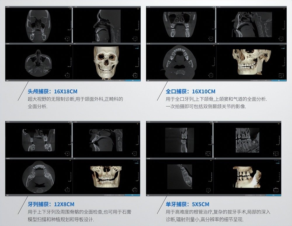 国内首台加持小牙片的口腔CT，博爵五合一CBCT是如何一次性解锁口腔影像全需求的？_凤凰网