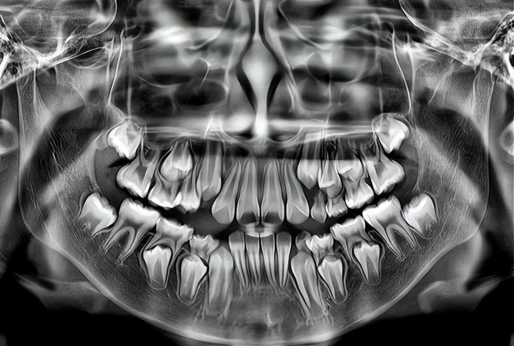 国内首台加持小牙片的口腔CT，博爵五合一CBCT是如何一次性解锁口腔影像全需求的？_凤凰网