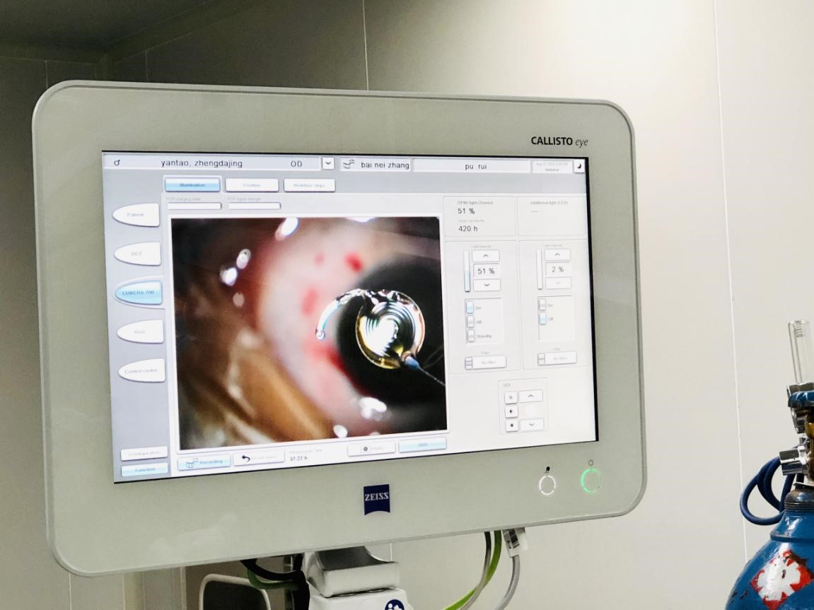 湖北省首批PanOptix三焦点人工晶状体植入手术在武汉普瑞眼科医院成功开展_湖北频道_凤凰网
