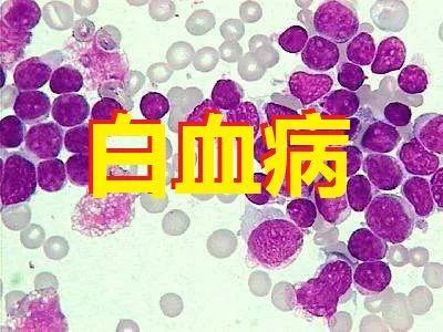 白血病新药!Chimerix签署6亿美元协议获CX-01独家权利,一线治疗AML完全缓解率高达89%__凤凰网