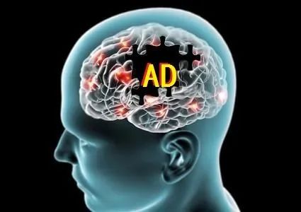 阿尔茨海默诊断重磅！首个tau病理成像剂-礼来Tauvid(flortaucipir F 18)获FDA批准__凤凰网