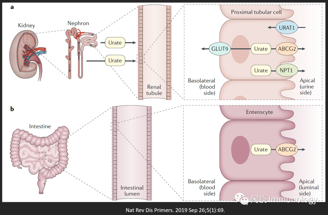 痛风：IL-1β驱动的炎症性关节炎__凤凰网