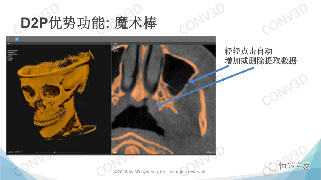 D2P™ 医疗CT三维建模软件From DICOM-to-PRINT__凤凰网