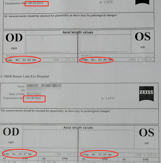 那些戴OK镜的孩子，后来视力怎么样了？__凤凰网