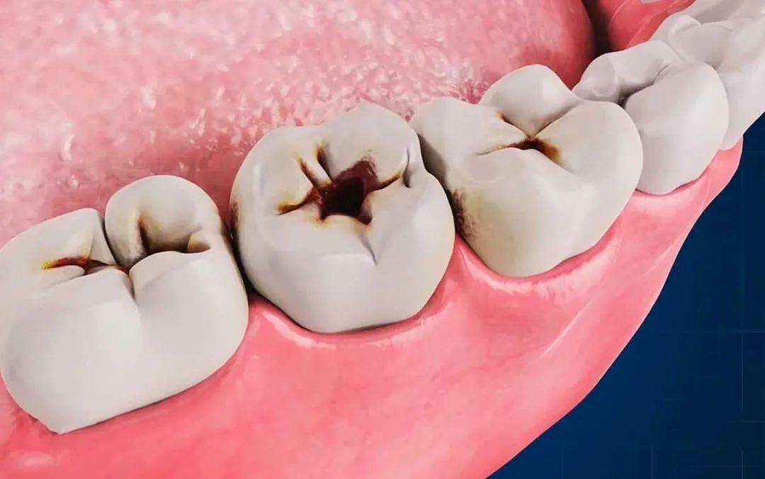 95 后小花 battle 颜值，都没逃过这口牙_凤凰网