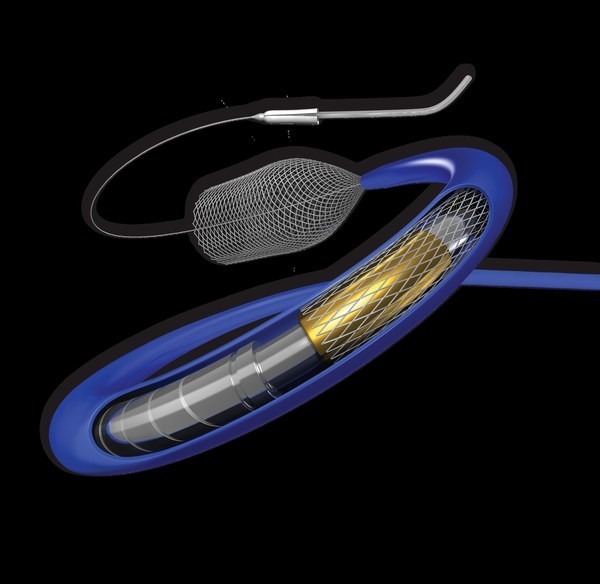 里程碑-美敦力Pipeline血流导向密网支架再获权威临床验证__凤凰网