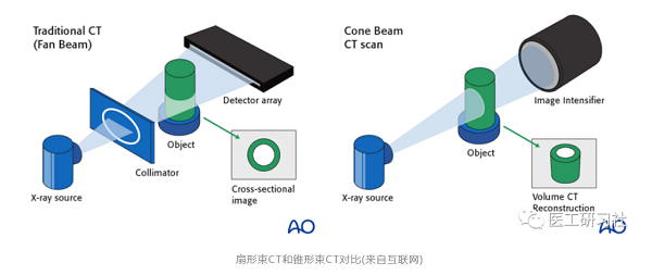 详解CBCT-DR技术原理 西门子医疗与安健科技推出全球两款CBCT-DR_凤凰网