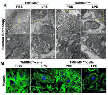 Metabolism/南方科技大学王艺瑾课题组揭示TMBIM6与VDAC1互作模式维持线粒体质量控制减轻脓毒症分子机制__凤凰网