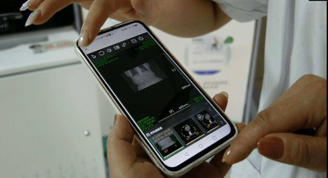 30万居民用上“云胶片”！ UCloud优刻得助力贵阳开阳县构建“医疗影像云”_凤凰网区域_凤凰网