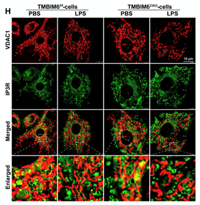 Metabolism/南方科技大学王艺瑾课题组揭示TMBIM6与VDAC1互作模式维持线粒体质量控制减轻脓毒症分子机制__凤凰网