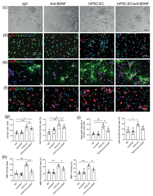 顾雨春团队合作揭示iPSC来源内皮细胞移植通过BDNF介导mTORC1通路促进中枢神经系统（CNS）髓鞘再生_凤凰网