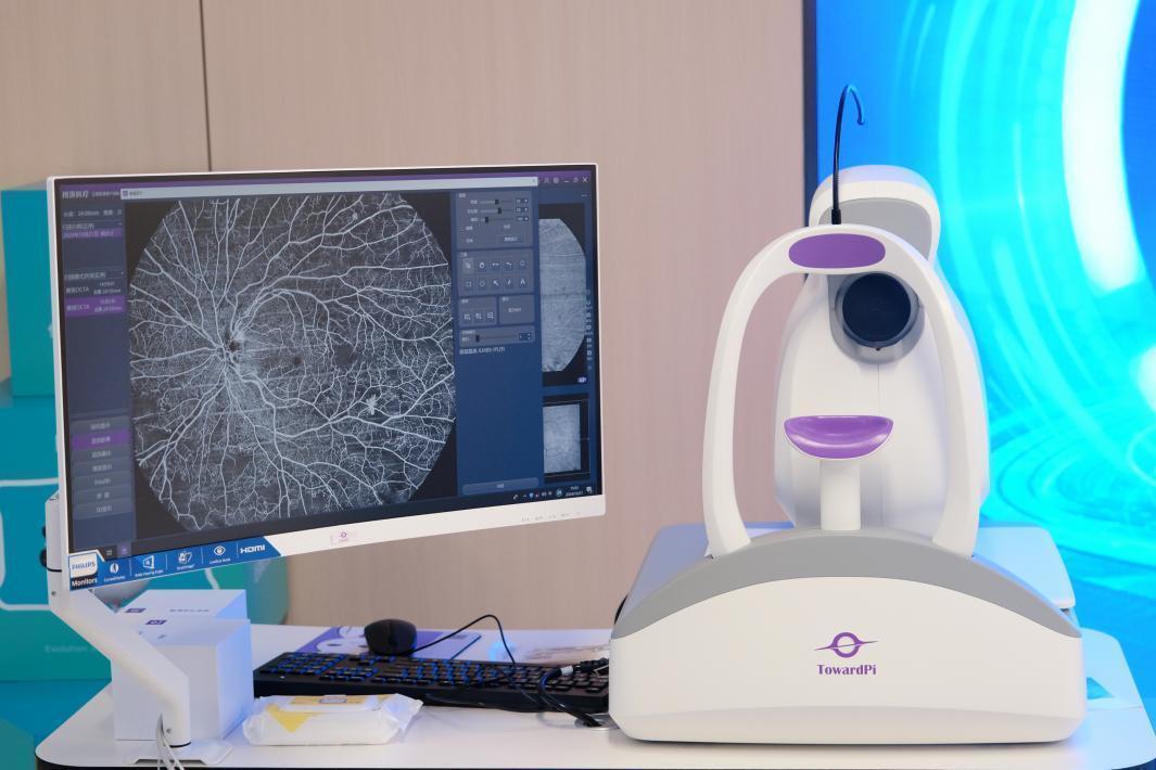 糖网患者福音！合肥普瑞眼科医院重磅引进40万次超广角全域扫频OCT/OCTA_凤凰网区域_凤凰网