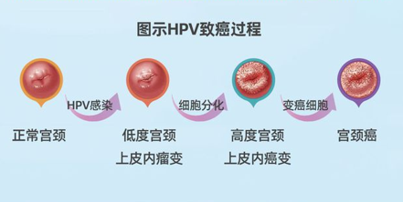 HPV阳性≠世界末日 “42天转阴疗法”开启可控清除新路径_凤凰网区域_凤凰网