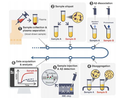 世界首例，一滴血可提前10年确诊老年痴呆症？中国也有类似技术_凤凰网