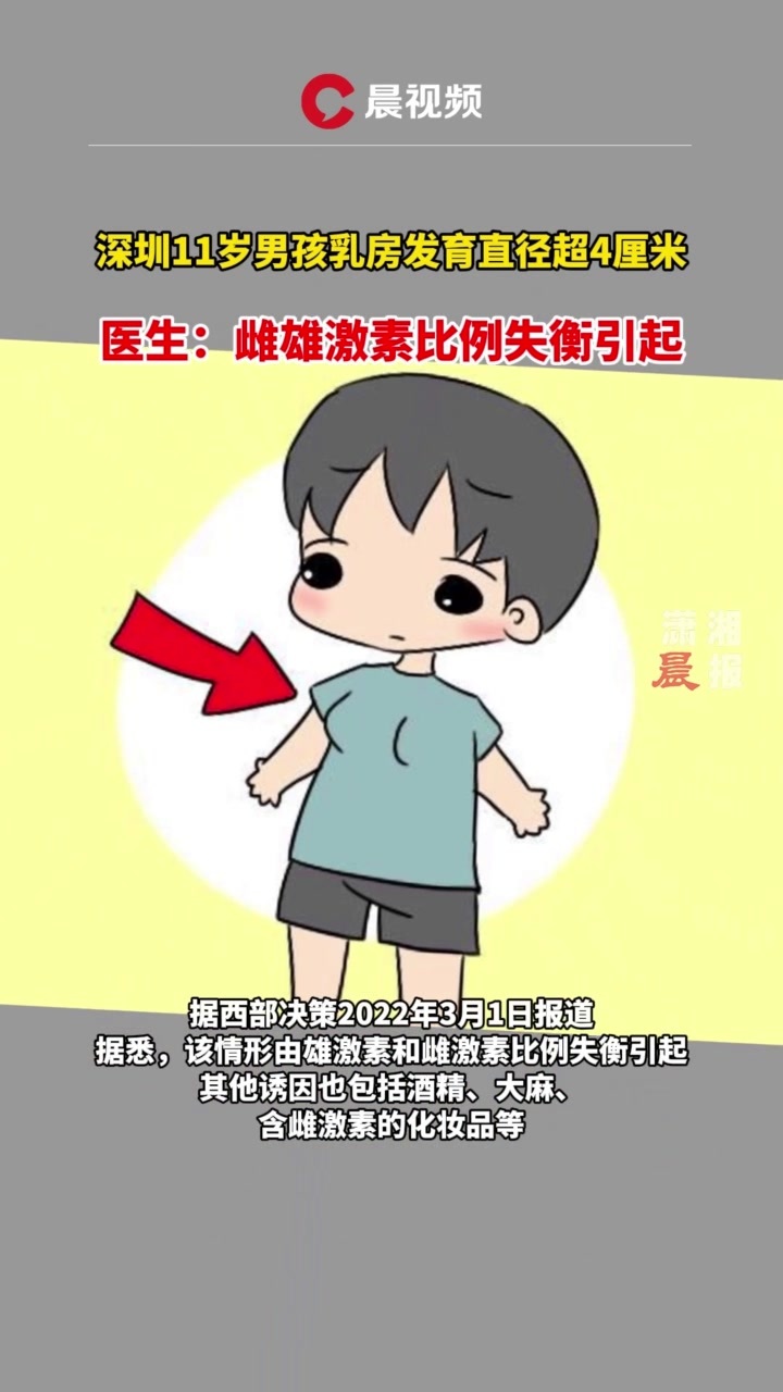 11岁男孩乳房发育直径超4厘米,医生:因雌雄激素比例失衡凤凰网视频凤凰网