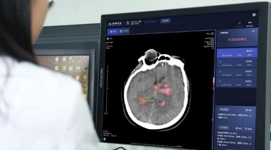 影像AI融合创新发展，数坤科技为医学影像诊断提质增速凤凰网山东_凤凰网