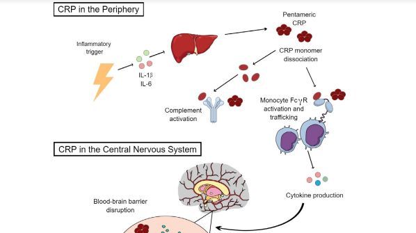 C 反应蛋白升高的 8 种临床意义解读，不只是细菌感染_凤凰网健康_凤凰网